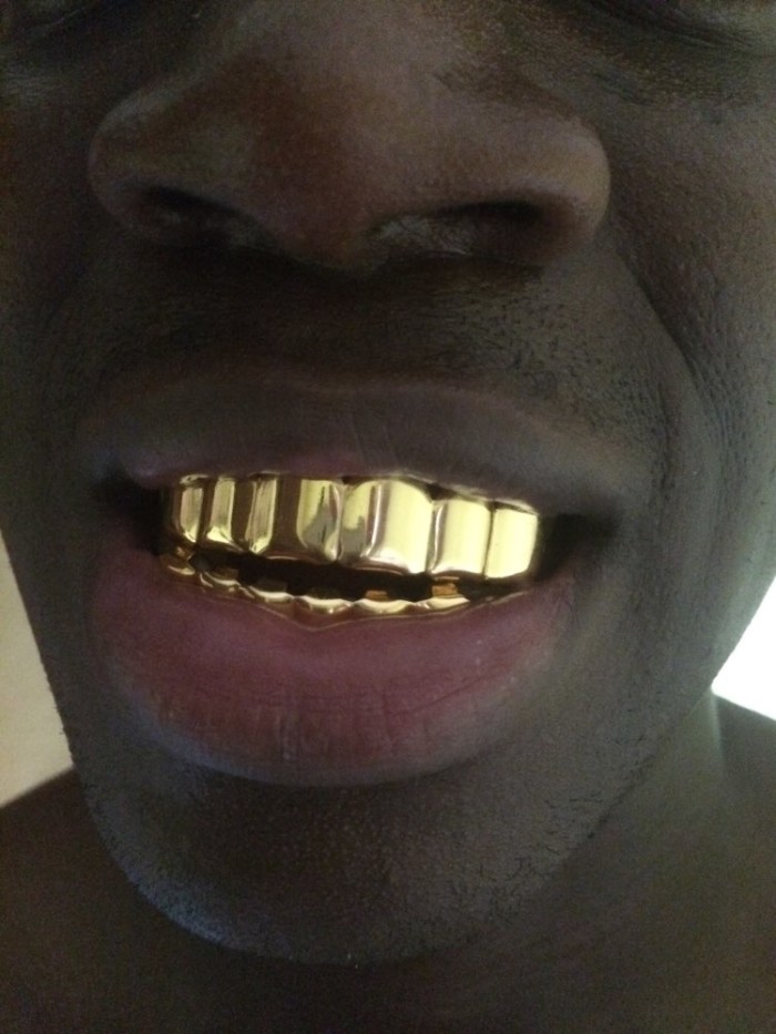 Premium 14K Gold Grillz - Best Value At DeezGrillz