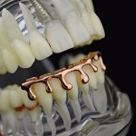 14K Rose Gold Drip Grillz - Bottom Only - Deez Grillz